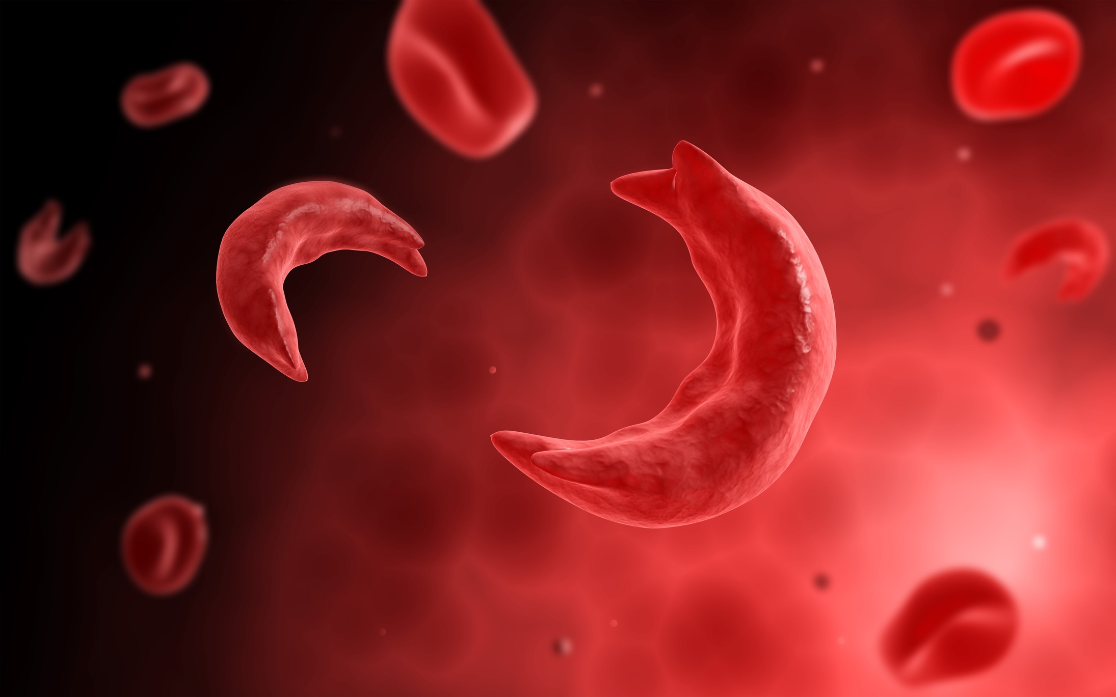 A Better Treatment For Sickle Cell Disease – Texas A&M Stories